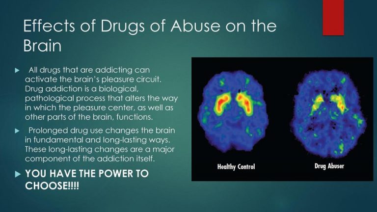 Effects+of+Drugs+of+Abuse+on+the+Brain - Montgomery Municipal Cable ...
