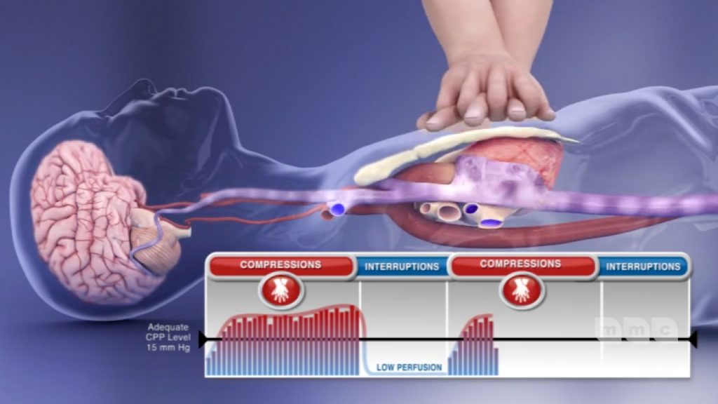 CPR Would You Know What To Do??? - Montgomery Municipal Cable ...